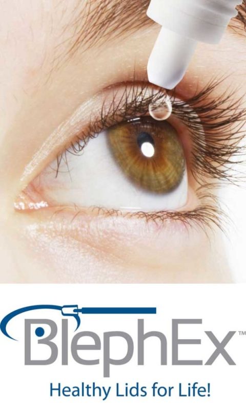 Blephex Treatment | Calgary Eye Clinics - Optometrist, Eye Exams